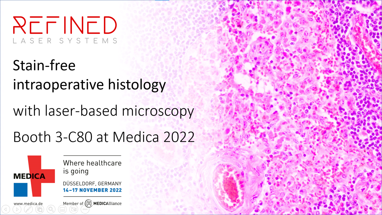 Companynews – Refined Laser Systems