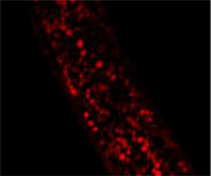 Noctua – Refined Laser Systems